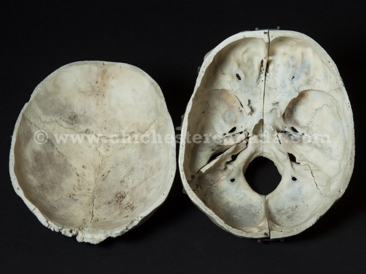 Real Human Skulls